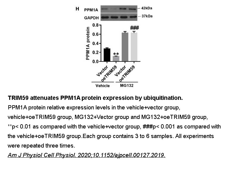 美国APExBIO中文官网 - MG-132|Proteasome inhibitor, Cell permeable, reversible ...