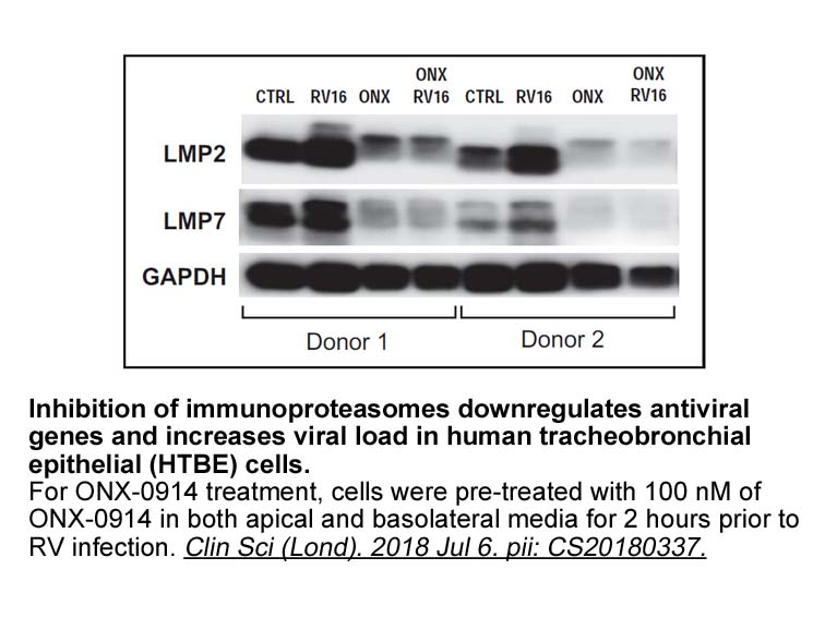 美国APExBIO中文官网 - ONX-0914 (PR-957)|Immunoproteasome inhibitor,potent and ... 美国APExBIO中文官网 - ONX-0914 (PR-957)|Immunoproteasome inhibitor,potent and ...